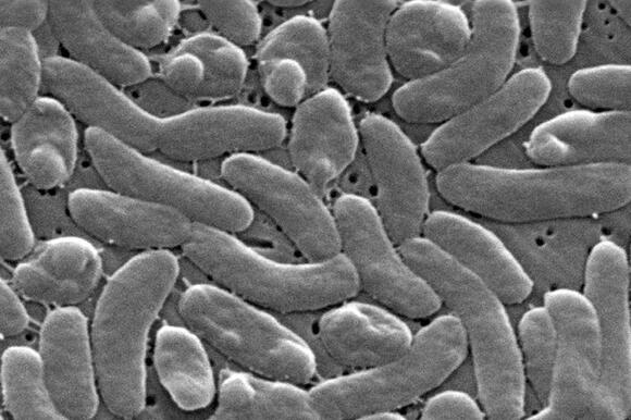 Vibrio season is here: How can you avoid the flesh-eating bacterial ...