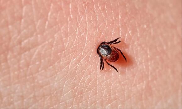 Baby Ticks (Seed Ticks): 6 Pictures and How to Get Rid of Them - NewsBreak