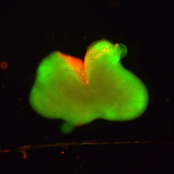 Lab-Grown “Mini” Human Spinal Cords Healed In Major Step Towards ...