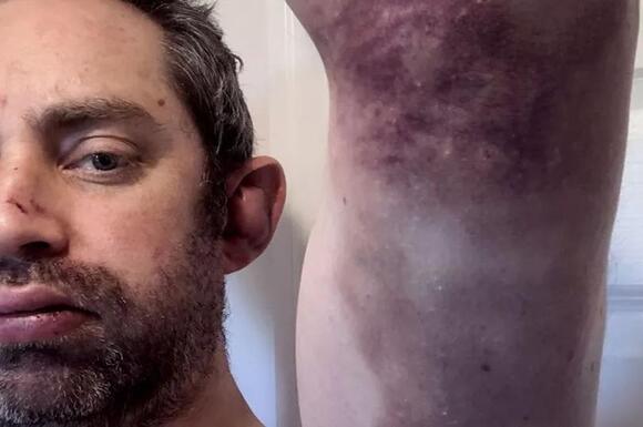 Heartwrenching new Netflix docuseries leaves viewers feeling ...