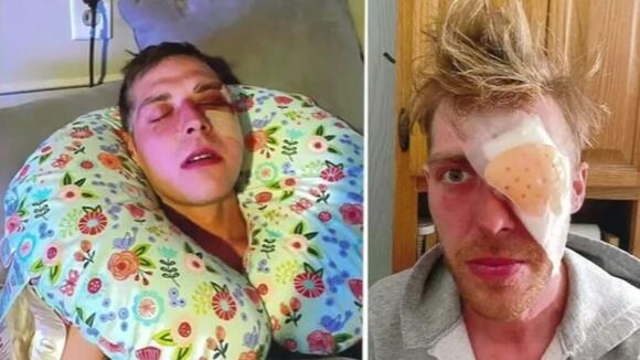 “Like squishing a grape”: Man who lost eye after police sucker punch ...