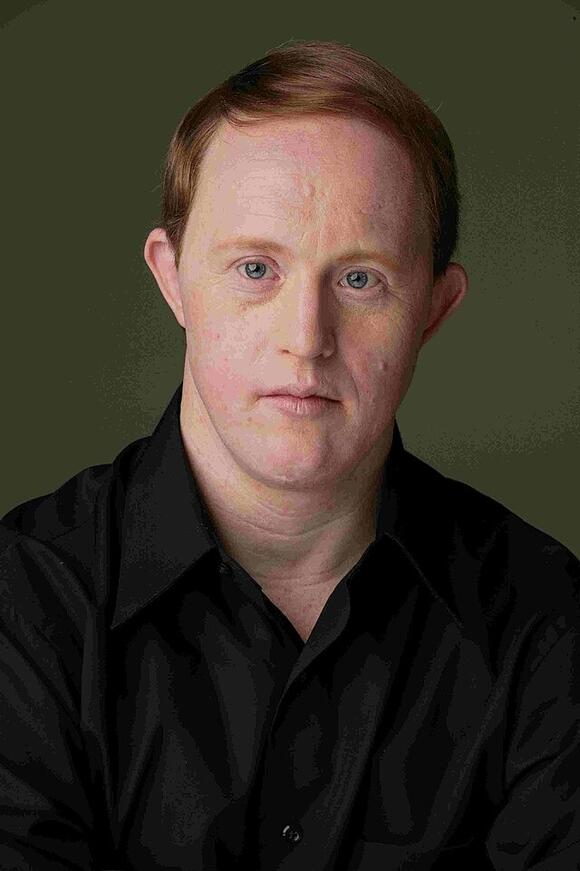 Actor Chris Burke, Who Has Down Syndrome, Has Blazed A Trail For ...