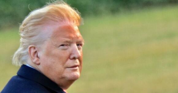 Donald Trump’s Tan Disaster Goes Viral—You Won’t Believe the Hilarious ...
