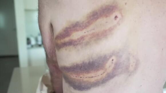 Man hospitalized with serious injuries after boxing-style fight with ...