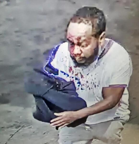 Detroit police looking for suspect who set car on fire, damaging ...