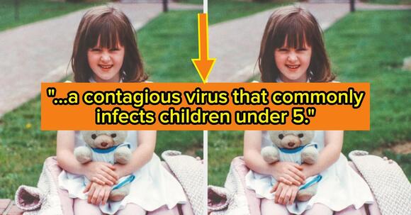 A Highly Contagious Virus Is Spreading Like Wildfire, And Doctors Want ...