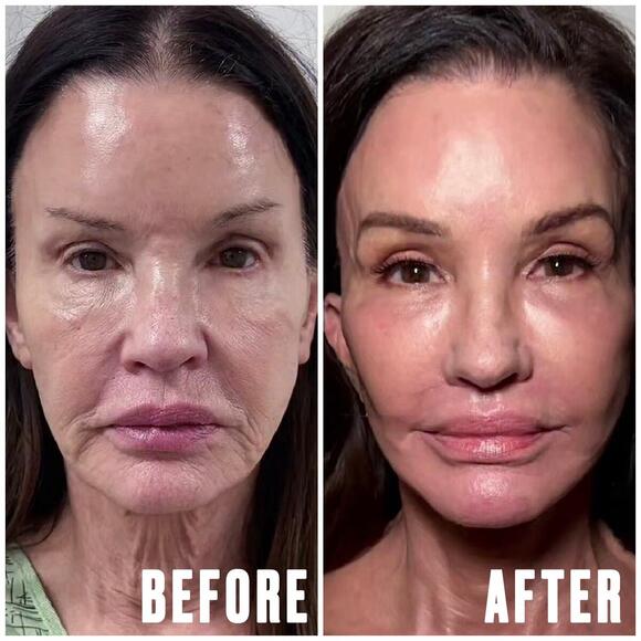 ‘America’s Next Top Model’ Star Reveals Jaw-Dropping Facelift - NewsBreak