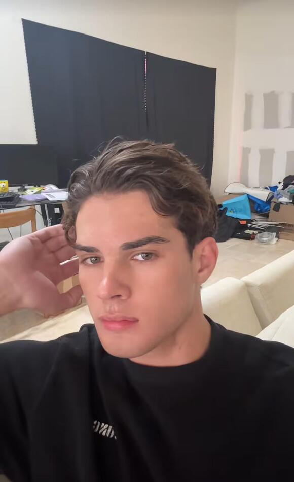 Looksmaxxing Influencer Clavicular's Nose Job Reveal Draws Brutal ...