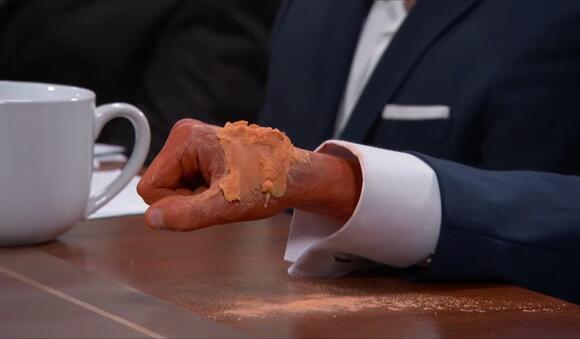 Donald Trump’s Worst Hand Bruise Yet Horrifies Jimmy Kimmel - NewsBreak