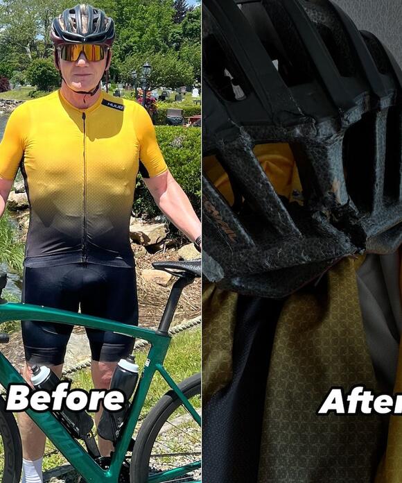 Gordon Ramsay Reveals Graphic Injury from Bike Accident: ‘Lucky to Be Here’