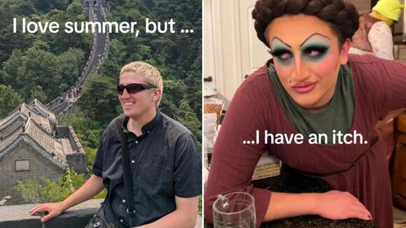'I love summer... but I have an itch' TikTok trend already has people ...