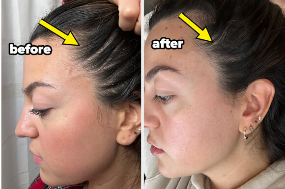 Here's What You Need To Know About The Viral "Hair Oiling" Trend ...
