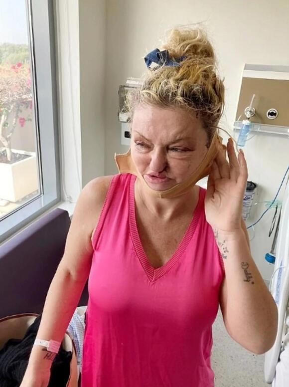 Danniella Westbrook Seen Swollen and Bruised in a Wheelchair After ...