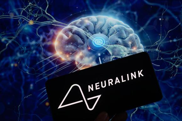 Elon Musk’s brain implant startup Neuralink surges in value to $9B: report - NewsBreak