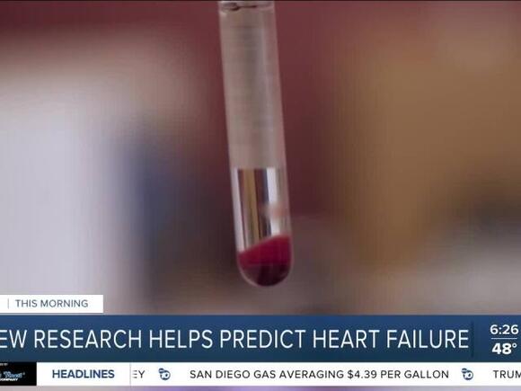 Blood test may predict heart problems, new UC San Diego Health study ...