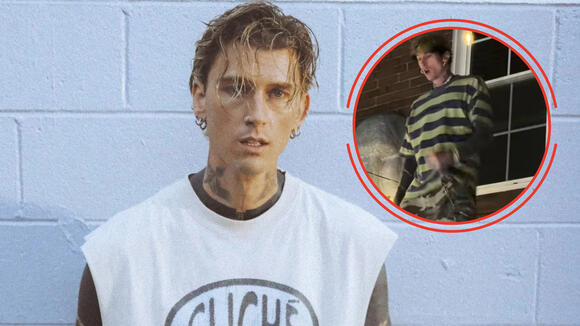 Machine Gun Kelly Suffers Brutal Spinal Injury After Vaulting Off ...
