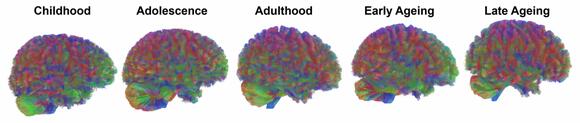 Fatherhood Dramatically Rewires Your Brain, Scans Reveal - NewsBreak