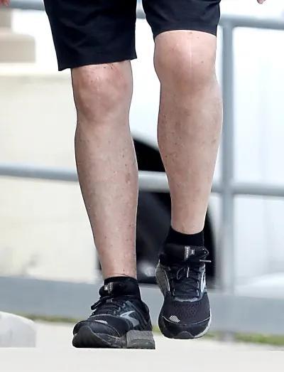Tom Selleck Spotted With Apparent Knee Surgery Scars in 1st Public ...