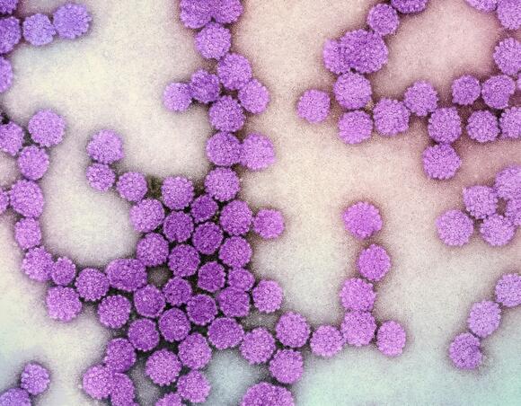 How Microbial Life Thrives in the Most Extreme Environments on Earth ...