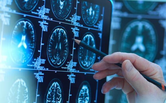 St. Louis Teen Finally Comes Clean About Viral Fight That Caused Brain ...