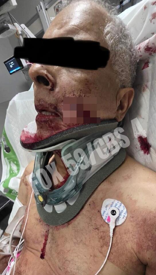 Mark Sanchez’s ex teammates stunned by Indy assault charges against ...