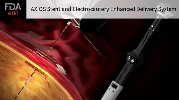 FDA Flags Boston Scientific Device Tied to 3 Deaths, Scores of Injuries ...