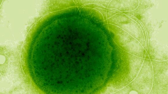 This Extreme Radiation-Resistant Organism Evolved a Remarkable Ability ...