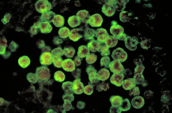 The Microscopic World Living Inside Your Showerhead - NewsBreak
