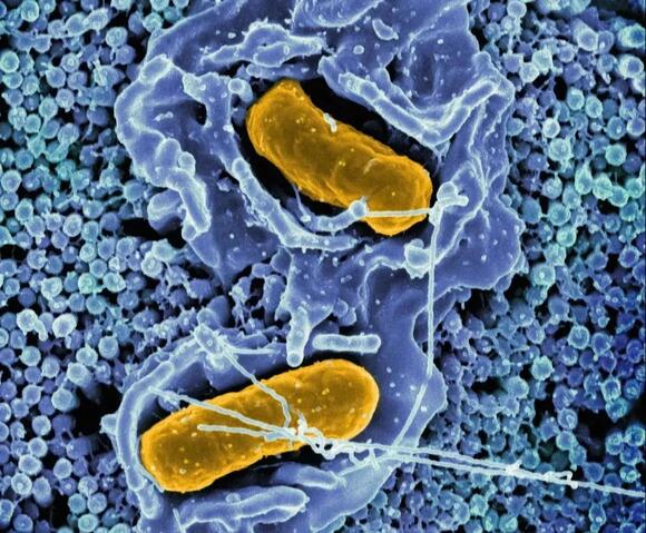 The Extraordinary Lives of Extreme Organisms: Life Beyond Limits ...