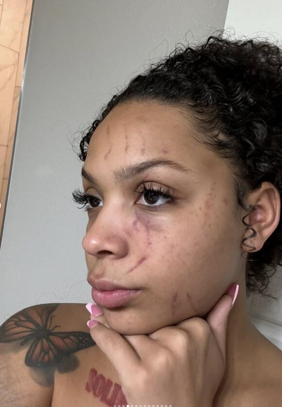 Who is Dacoda Nichole Jones? Rashee Rice’s Alleged Domestic Violence ...