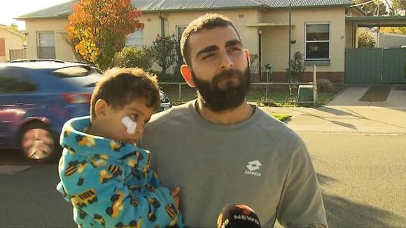 Owner flees after dog mauls 3-year-old boy, tearing skin off his face ...