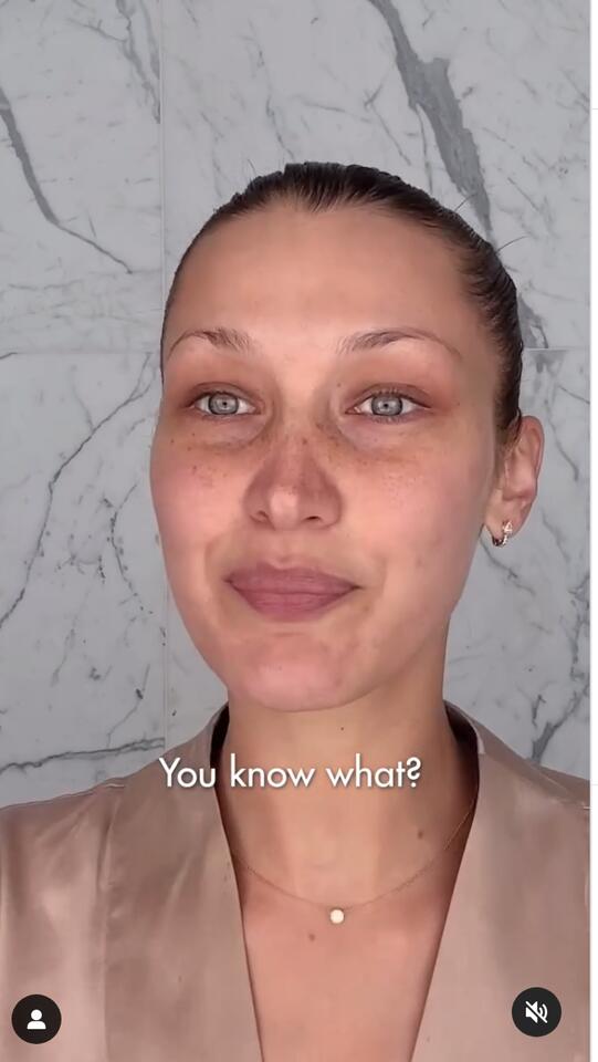 Bella Hadid Addressed Facelift And Fox Eye Lift Surgery Rumors - NewsBreak