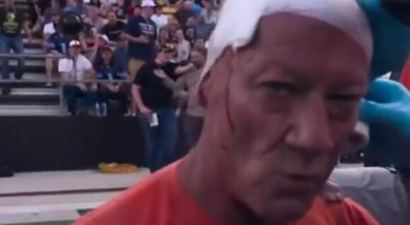 Fox Cameraman Suffers Bloody Head Injury After Sideline Collision with ...