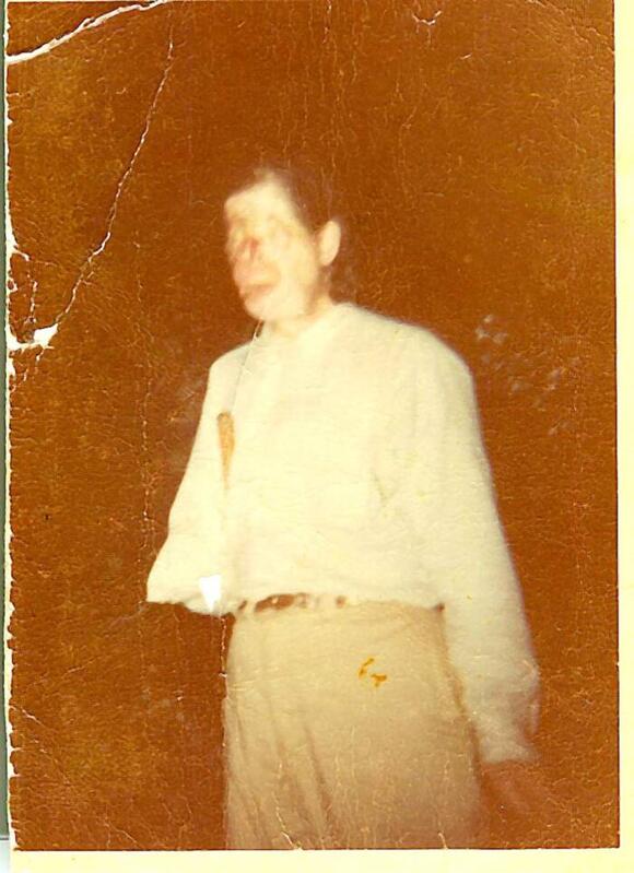 Raymond Robinson: The Real-Life Urban Legend Of ‘Charlie No-Face ...