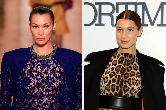 Bella Hadid Addressed Facelift And Fox Eye Lift Surgery Rumors - NewsBreak