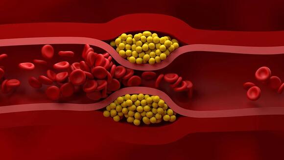 US Cardiologists Have Just Published New Guidelines For Managing ...
