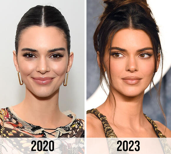 Fans Think Kendall Jenner Had 'Secret Surgery' After Noticing Some ...