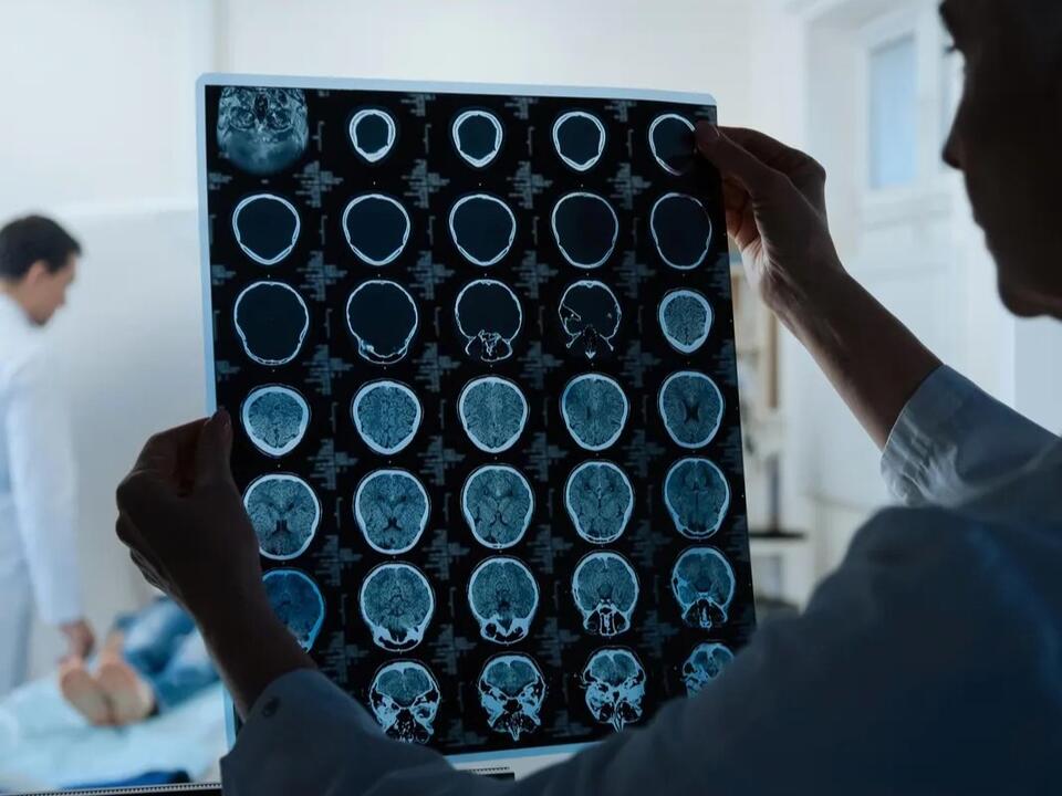 15 Facts About Brain Tumor Survival Rate By Age