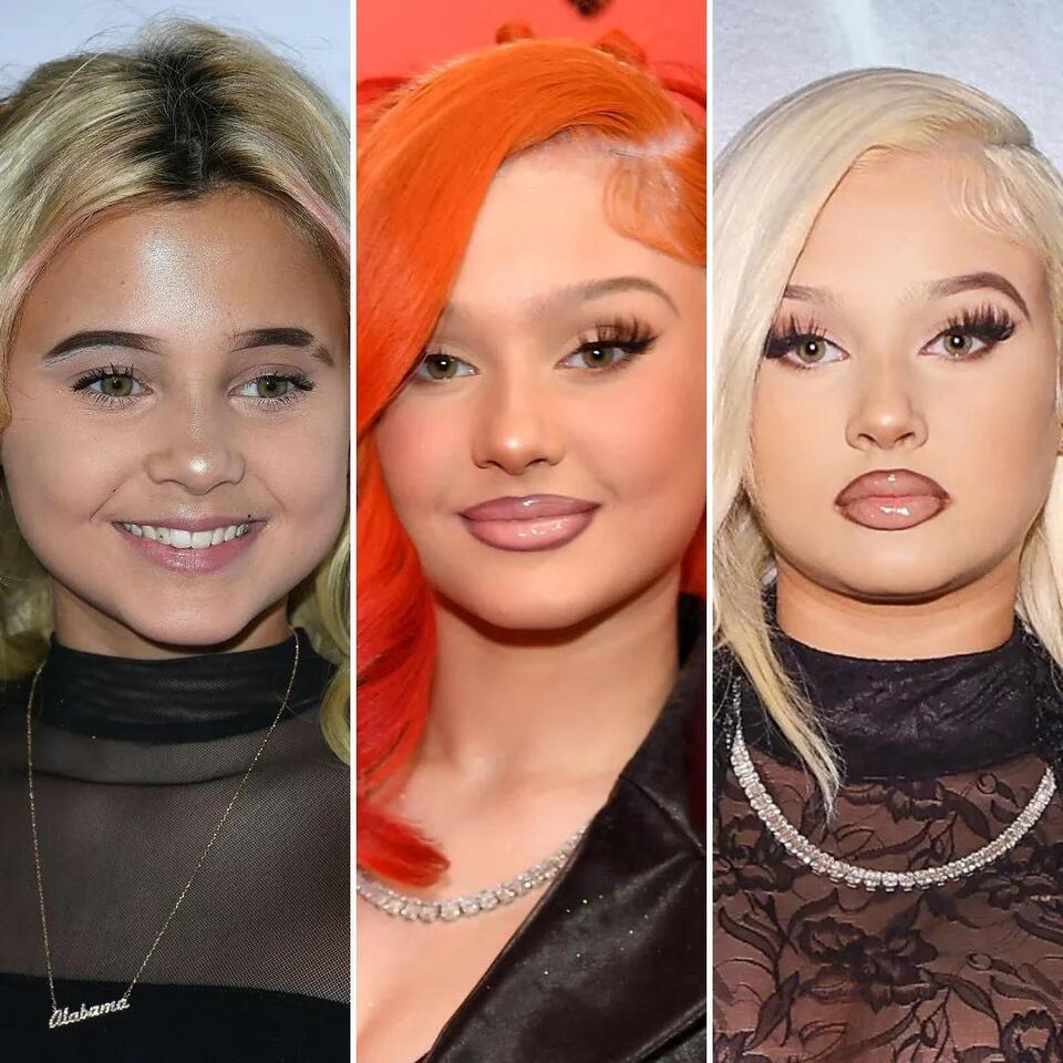 Did Alabama Barker Get Plastic Surgery? Travis Barker and Shanna ...