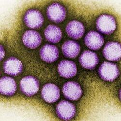 Oldest Known Human Viruses Discovered In 50,000-Year-Old Neanderthal ...