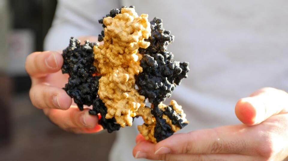 Rare 'Brain on Fire' disorder highlighted in Netflix film may soon have ...