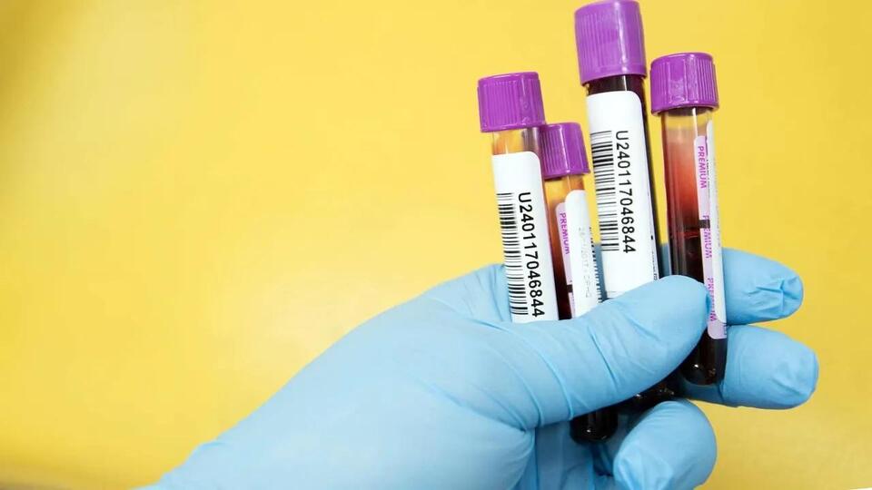 Blood Test Can Help Identify Cancer in Patients With Non-Specific ...