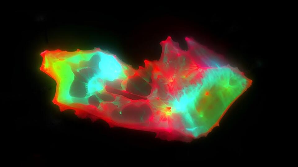 Strange Structures Found Lurking in The Blood of People With Long COVID ...