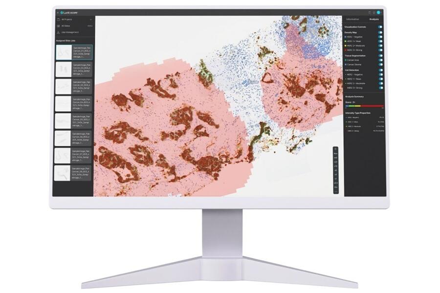 AI-Powered Pathology Solutions Accurately Predict Outcomes for HER2 ...