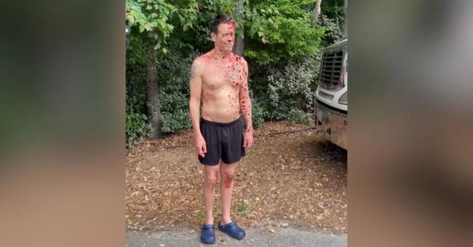 Kevin Bacon, 66, Looks Hunky in Bloody Behind-the-Scenes Moments From ...