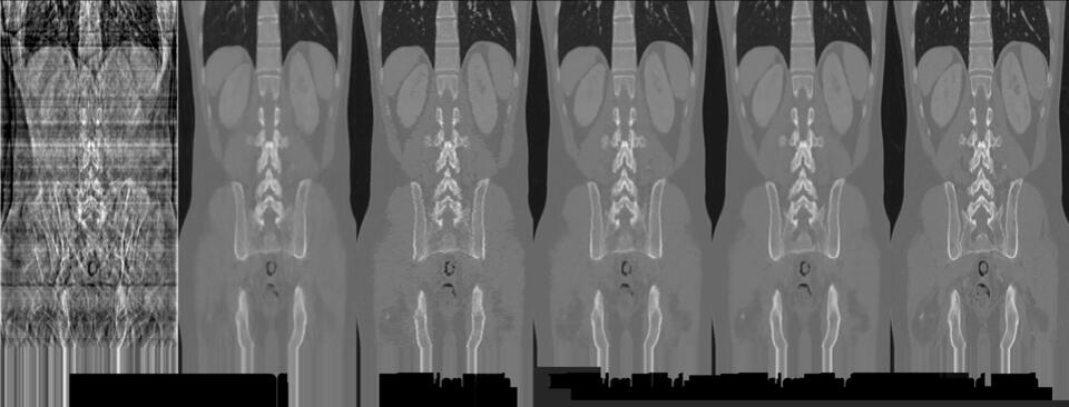 New generative AI model can reconstruct a high-quality, sparse-view 3D ...
