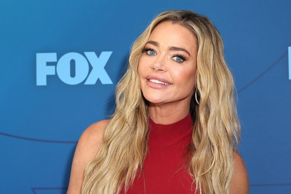 Denise Richards Tried Salmon Sperm Facial After Jennifer Aniston ...