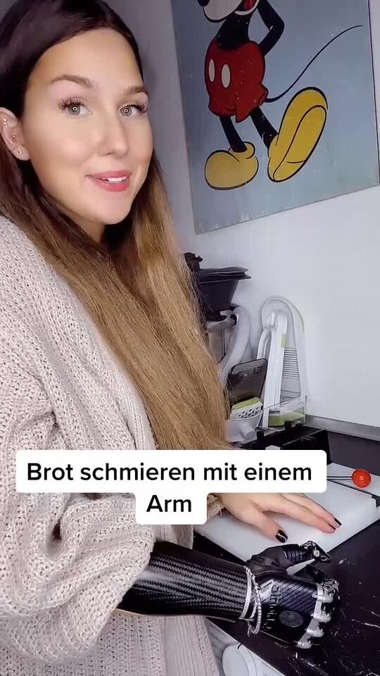 So gehts 🦾🥰 Instasize Gina.ruhl #amputee #amputeegirl #prosthetic #fyp ...