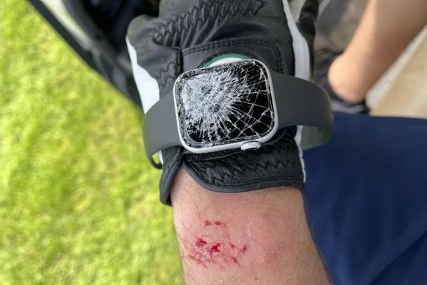 Slice from wrong fairway shatters golfer's Apple Watch in ‘wild mishap ...