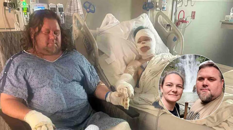 🔥 Atwood couple injured in taco truck explosion, community raises $25K ...